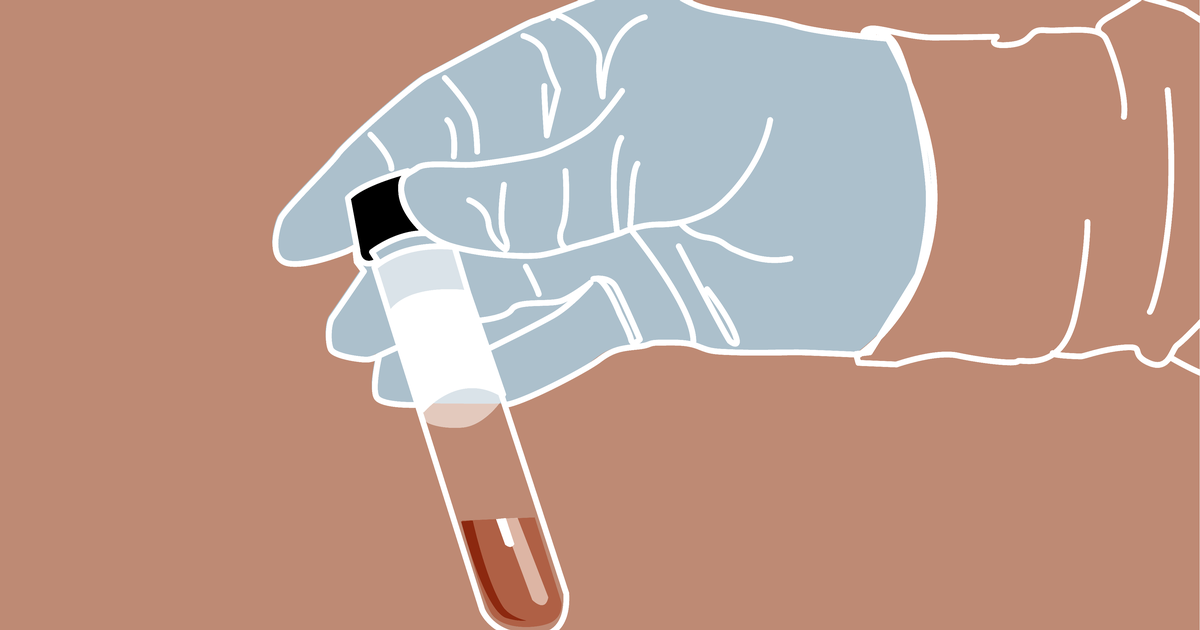 Nye tilfælde af abekopper i Danmark - Din Avis