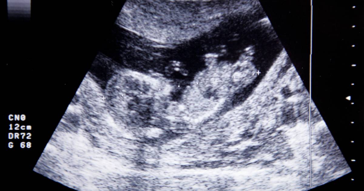 Regeringen vil sænke aldersgrænsen for fri abort - Jyllands-Posten