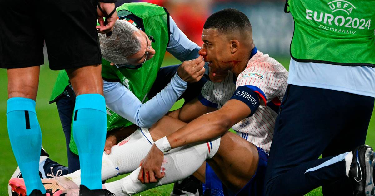 Mbappé undgår operation efter brækket næse - Jyllands-Posten