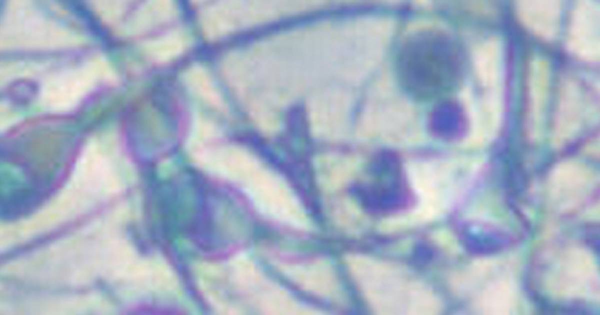 Testiklers størrelse har betydning - Jyllands-Posten