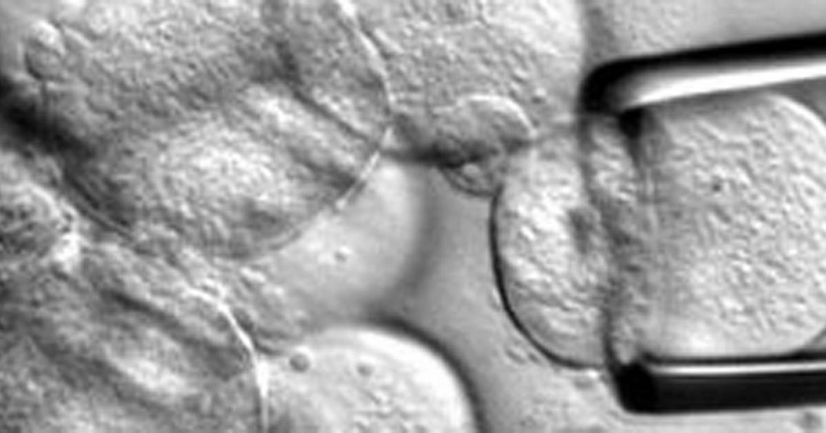 Stamceller skal forebygge lammelser