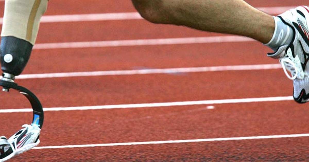 Proteser kan vokse sammen med kroppen